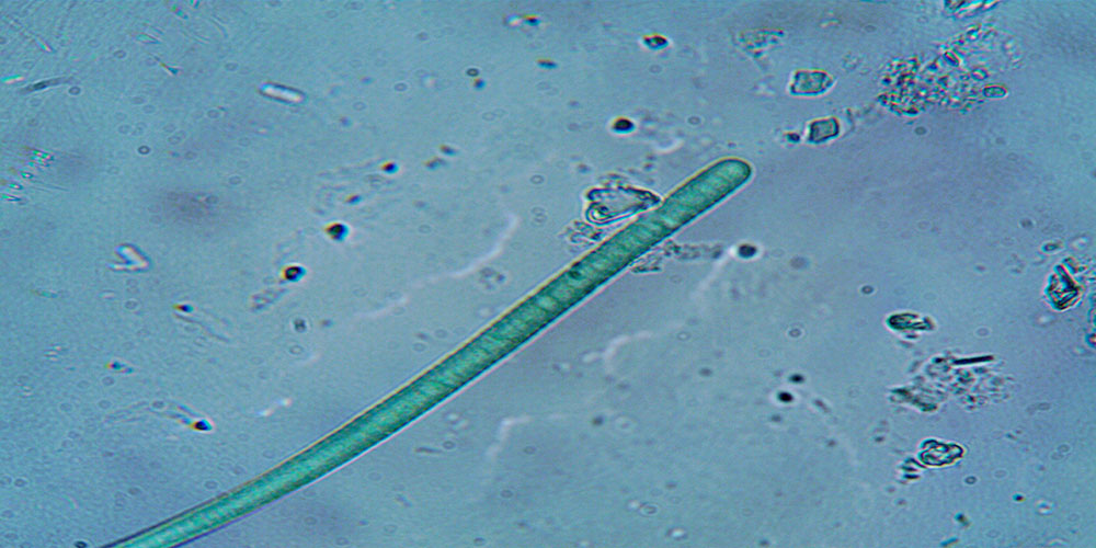 Nematodes I At Lone Star College Studyblue
